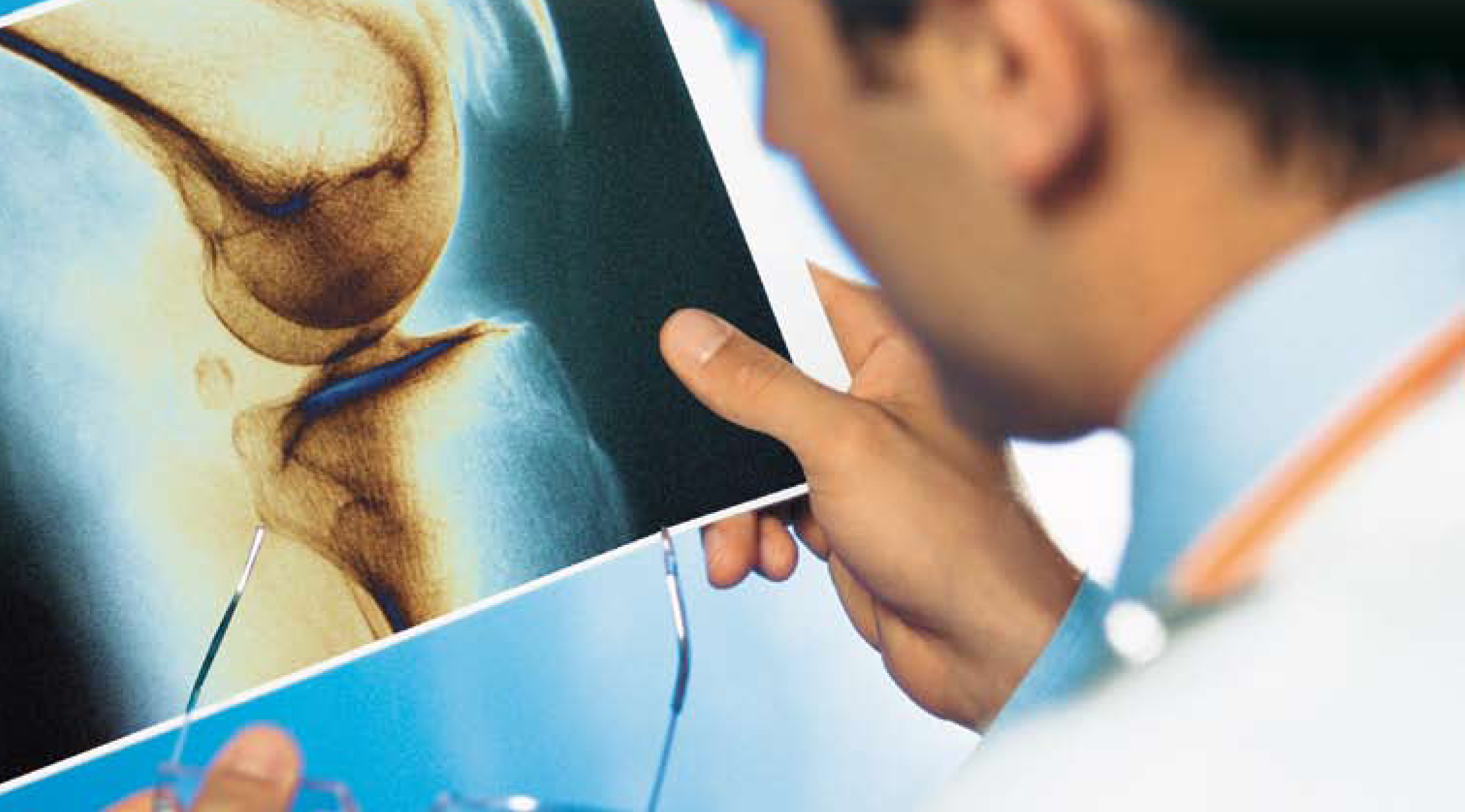 Are You Taking Care of Your Bones? - LivingBetter50